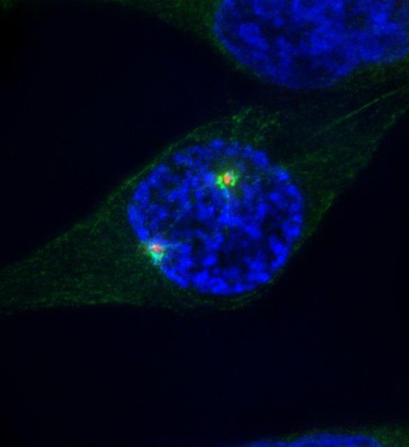Investigadores destacan el papel de las células senescentes en la ...